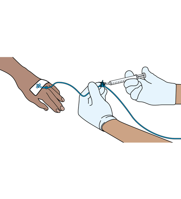 Treatment for acute lymphoblastic leukaemia (ALL leukemia) - Macmillan ...