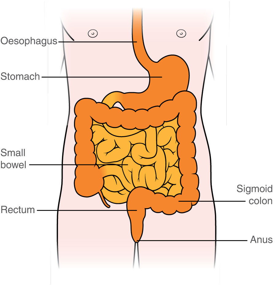 What Causes Appendix Cancer