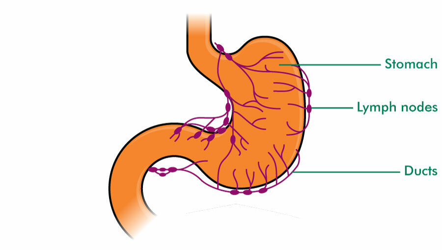 Lymph Nodes In Stomach Area